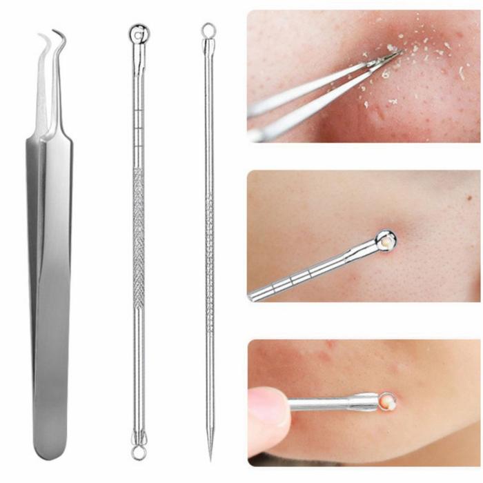 Jual Set Alat Pinset Pencet Jepit Komedo Jerawat 3in1 - Jakarta Pusat ...