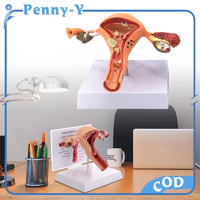 Jual 1set Alat Peraga Uterus Dan Ovarium Normal Dan Patologi Manekin ...