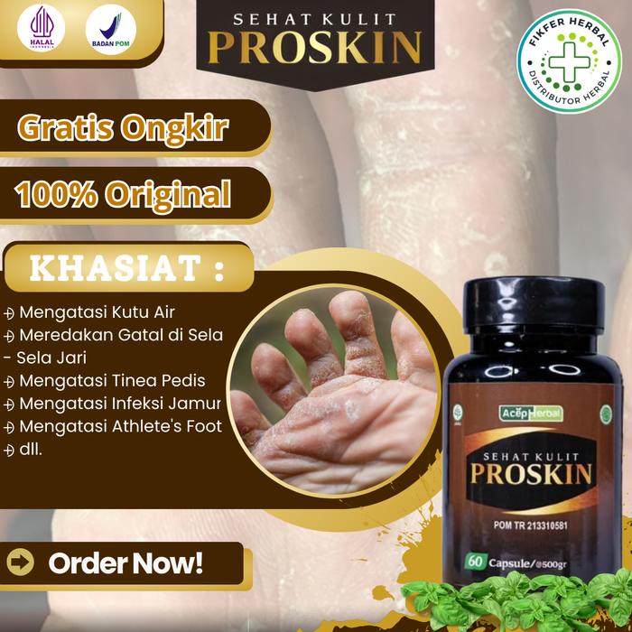 Jual Obat Kutu Air, Obat Tinea Pedis, Obat Bintik Kecil Berair ...