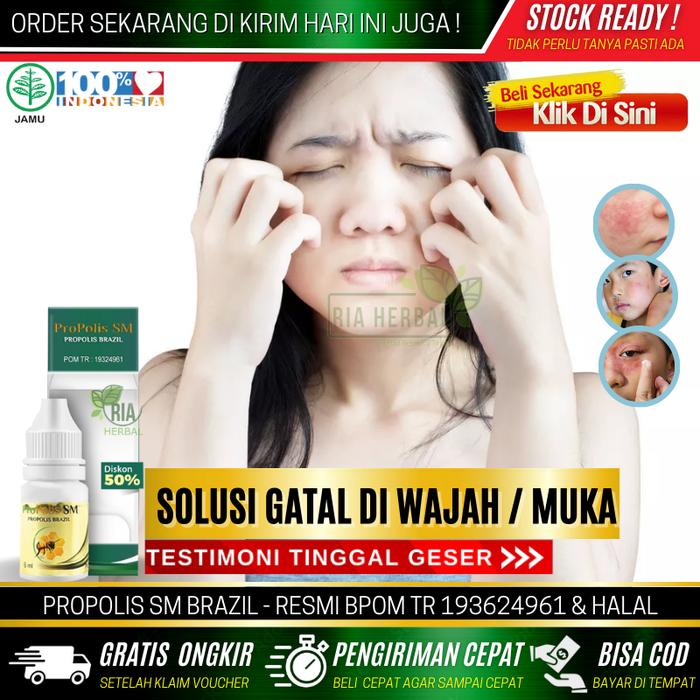 Jual Obat Wajah Gatal Dan Bentol Merah, Penghilang Gatel Di Muka Panas ...