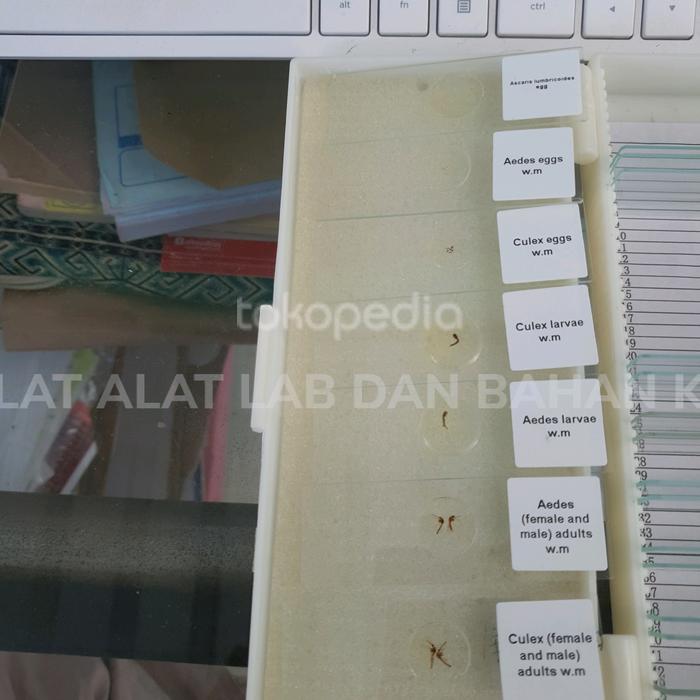 Jual Preparat parasitologi jenis nyamuk - Kab. Bantul - ALAT ALAT LAB ...