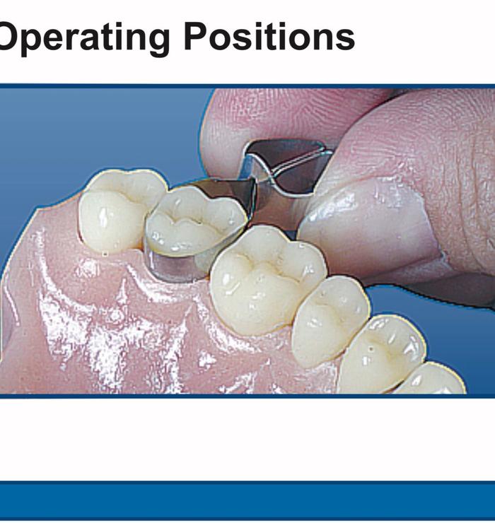 Jual Dental Matriks Pre molar / Premolar matrix - Jakarta Timur ...