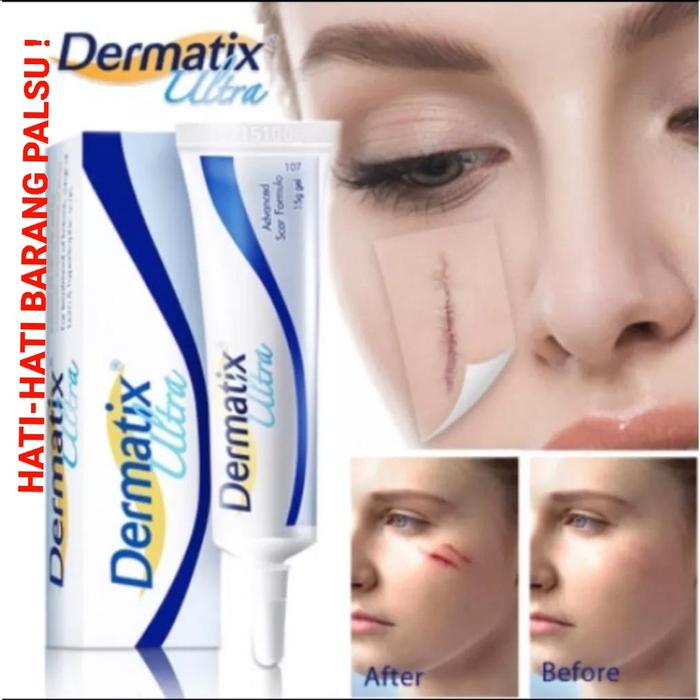Jual AWASPALSU! Salep Dermatix Ultra gel 15gr menyamarkan bekas luka ...