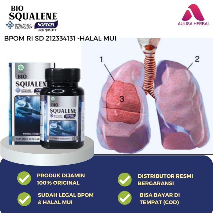 Jual Obat Penumpukan Cairan Pembungkus Paru Efusi Pleura Herbal ...