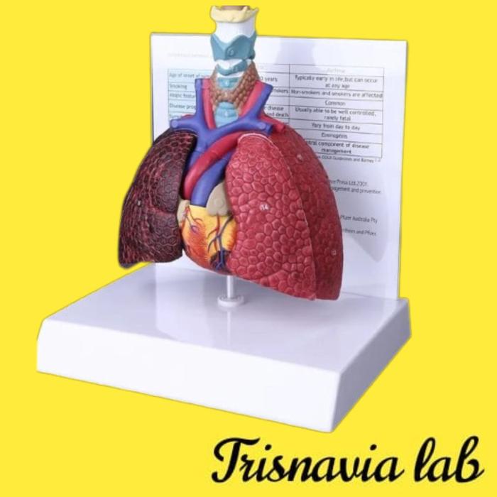 Jual Alat Peraga Sistem Pernapasan Paru-Paru Model Anatomi Manusia ...