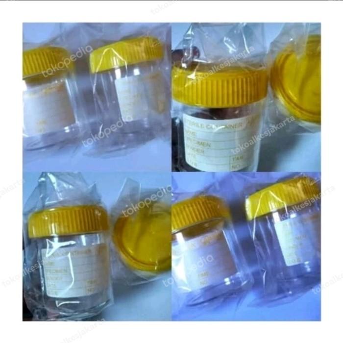 Jual Pot urine tutup kuning steril 60 ml - Kota Tangerang ...