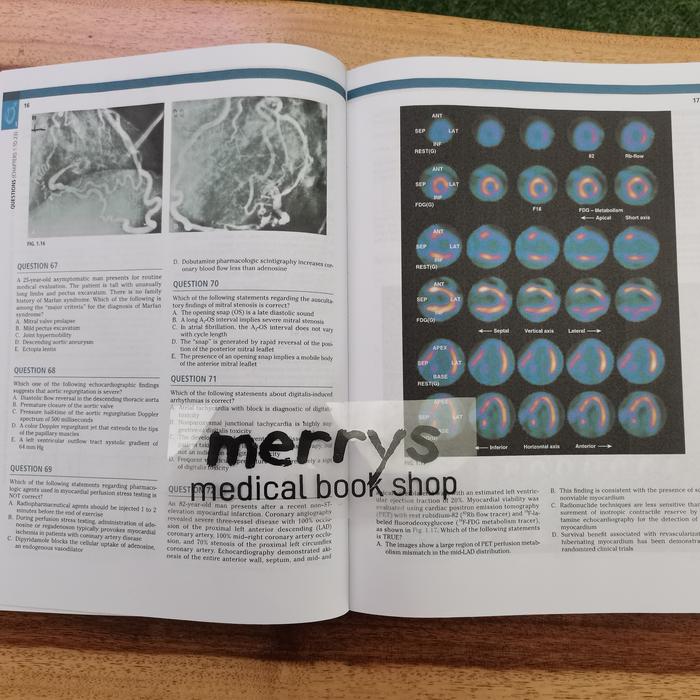 Jual [full Color /bw] Braunwald Heart Disease Review And Assessment Di ...