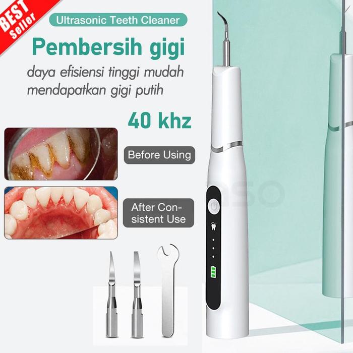 Jual Alat Pembersih Karang Gigi Scaling Sonic Elektrik 1 Set 3 Modes ...
