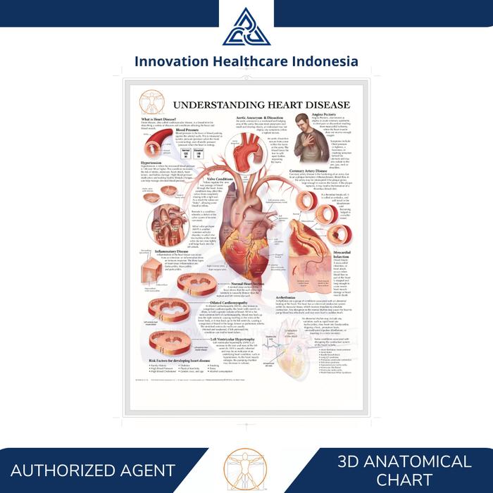 Promo 3D Anatomical Chart Understanding Heart Disease - Poster Edukasi ...