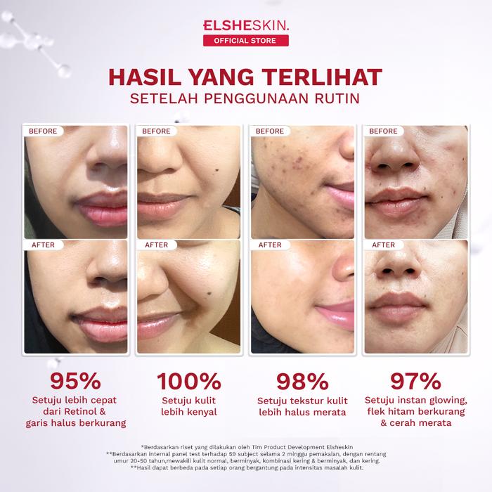Jual [new] Elsheskin Retinal Advance Serum 20ml Di Seller Yama ...