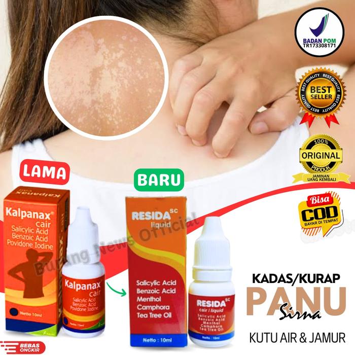 Promo Kalpanax Cair 100% Original Obat gatal Jamur Kulit Panu kadas ...