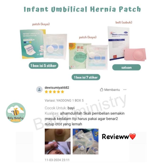 Jual Infant Umbilical Hernia Patch (penutup Pusar Bayi) Koyo Hernia Di ...