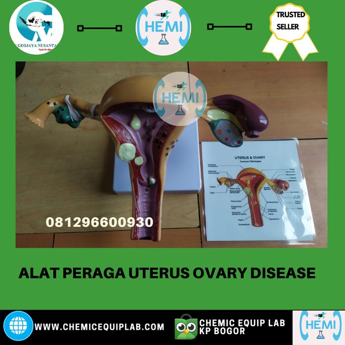 Jual ANATOMI FEMALE UTERUS OVARY DISEASE / UTERUS SAKIT ALAT PERAGA ...