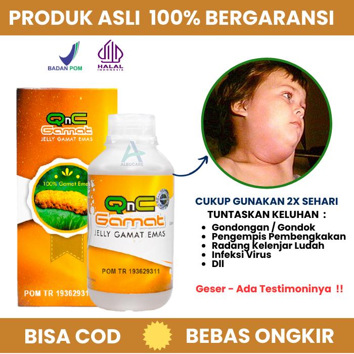 Jual Obat Gondongan, Pipi dan Leher Sekitar Rahang Bengkak, Parotitis ...