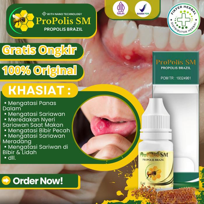 Jual Obat Tetes Sariawan, Obat Sariawan Parah, Sakit Bibir Akibat ...