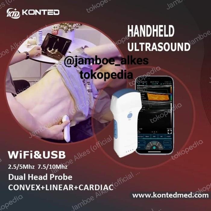 Jual USG 2 Head Wireless/Ultrasound probe 3in1 (Convex, Linear ...