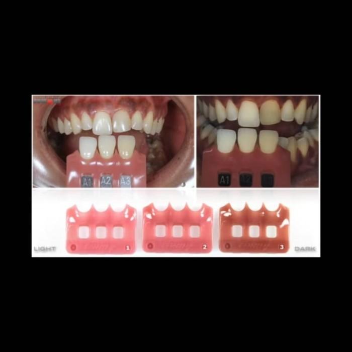 Jual SHOFU Dental Gingiva Indicator Shade Guide Tri Color Kit Panduan ...