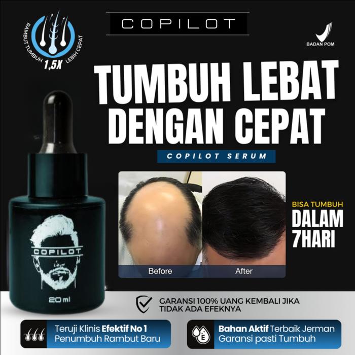 Jual PENUMBUH RAMBUT BOTAK - Penumbuh Brewok - Copilot BPOM - Kab ...