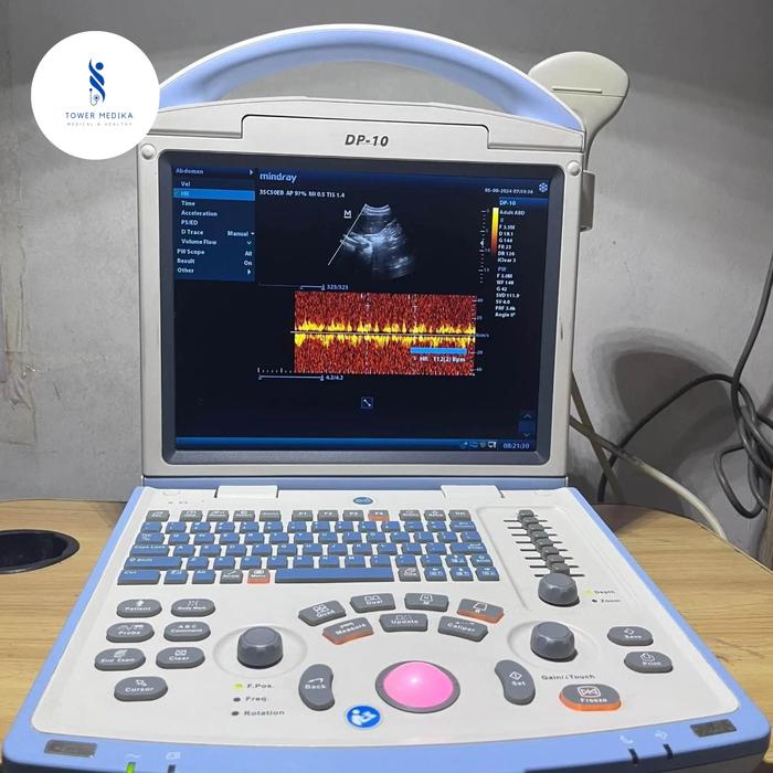 Jual USG MINDRAY DP10 (second) - Jakarta Timur - Tower medika | Tokopedia