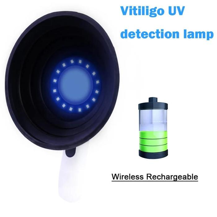 Jual NEW WOODS LIGHT SKIN EXAMINATION RINGWORM HANDHELD UV WOOD'S LAMP ...