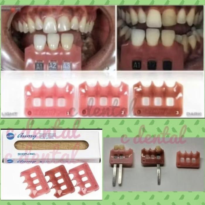 Jual SHOFU Dental Gingiva Indicator Shade Guide Tri Color Kit Panduan ...