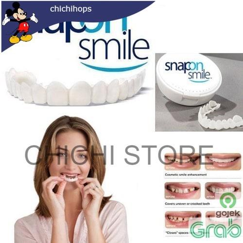 Jual SnapOn Smile Denture Elastic Removable Veneer Teeth Gigi Palsu CC ...