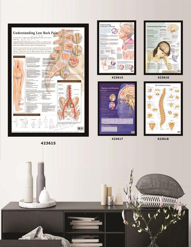 Jual Poster Kedokteran / Kesehatan / Understanding Low Back Pain - 1650 ...