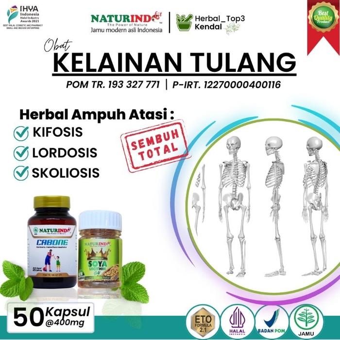 Jual Obat kelainan tulang skoliosis lordosis kifosis paket isi 2 botol ...