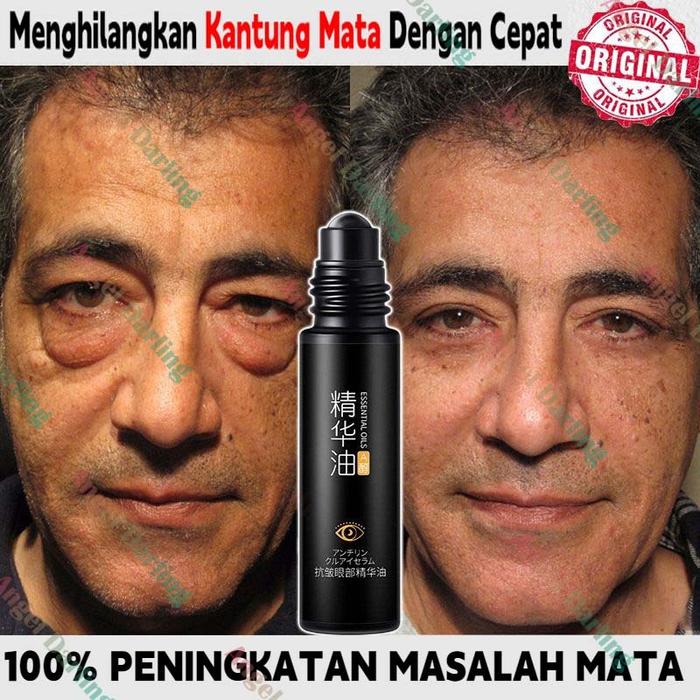 Jual serum mata cream Menghilangkan Kantung Mata Dengan Cepat Krim mata ...
