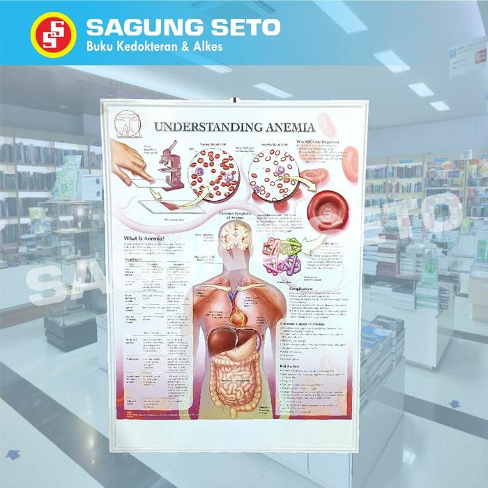 Promo POSTER UNDERSTANDING ANEMIA BS181 3D / POSTER MEMAHAMI ANEMIA 3D ...