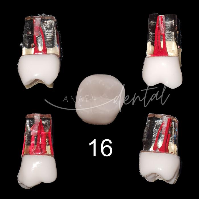 Jual Gigi Endodontik dengan Saluran Akar Endodontic Training Root Canal ...