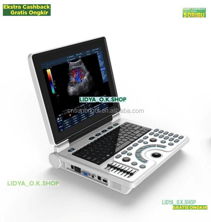 Jual O.K Portabel USG Alat Medis Ultrasonografi Mesin Laptop USG OB/GYN ...