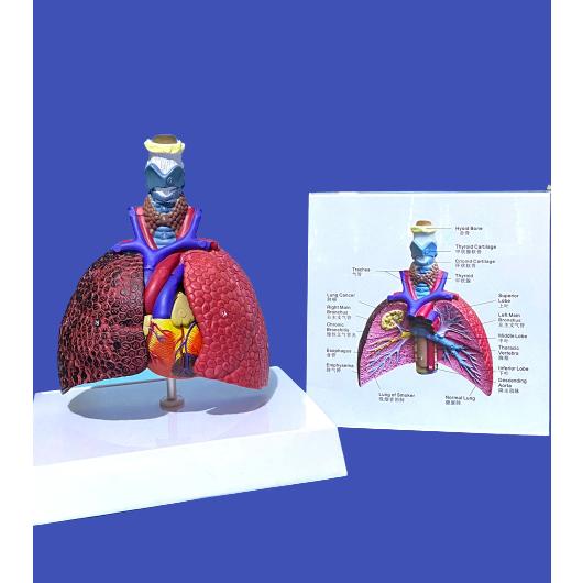 Jual Alat Peraga Paru-Paru Manusia Model Anatomi Sistem Pernapasan ...