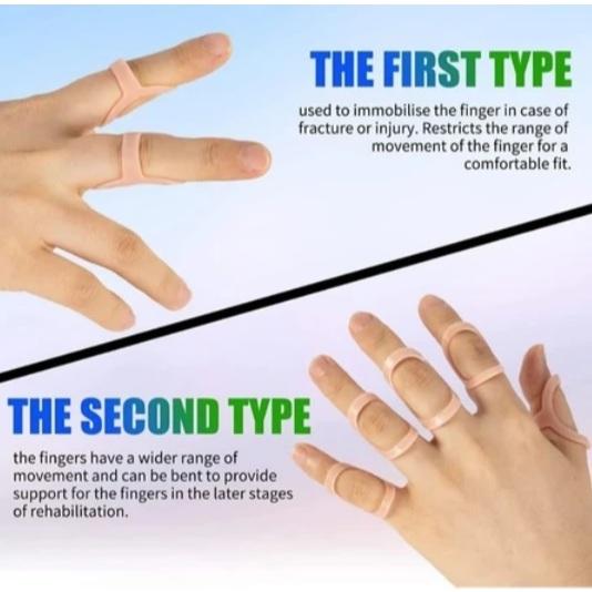 Promo Jari Leher Angsa Swan Neck Finger Splint Boutonniere Deformity ...