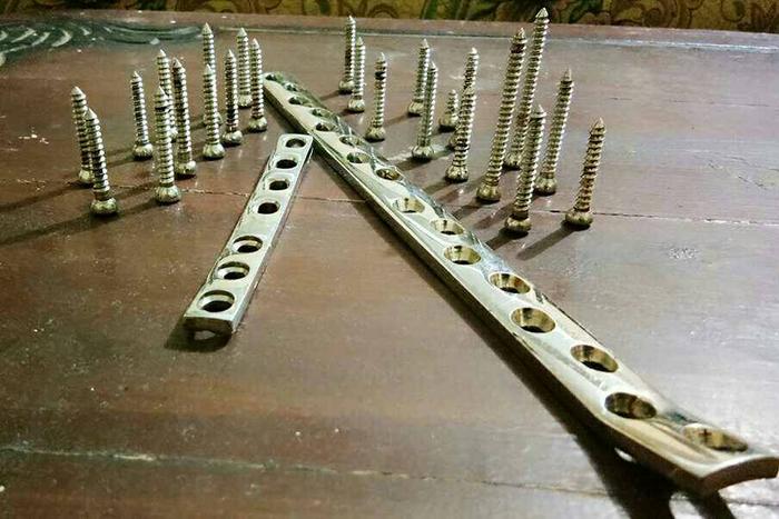 Jual Pen platina patah tulang paha tulang kering - Jakarta Timur ...