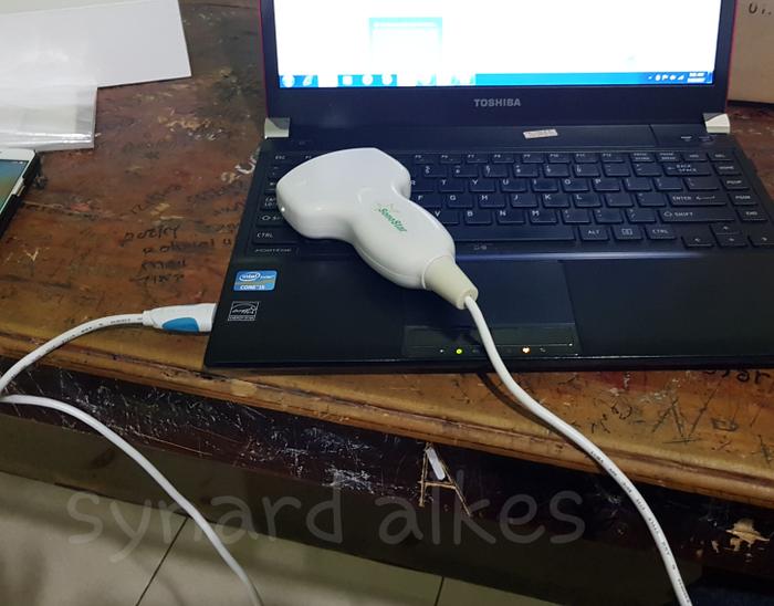 Jual USG PORTABLE Sonostar (mengunakan monitor Laptop) - Kota Makassar ...
