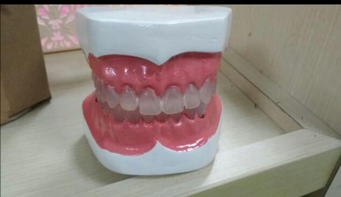 Jual Phantom Gigi - Phantom Dental Gigi Dewasa - Jakarta Pusat - Great ...