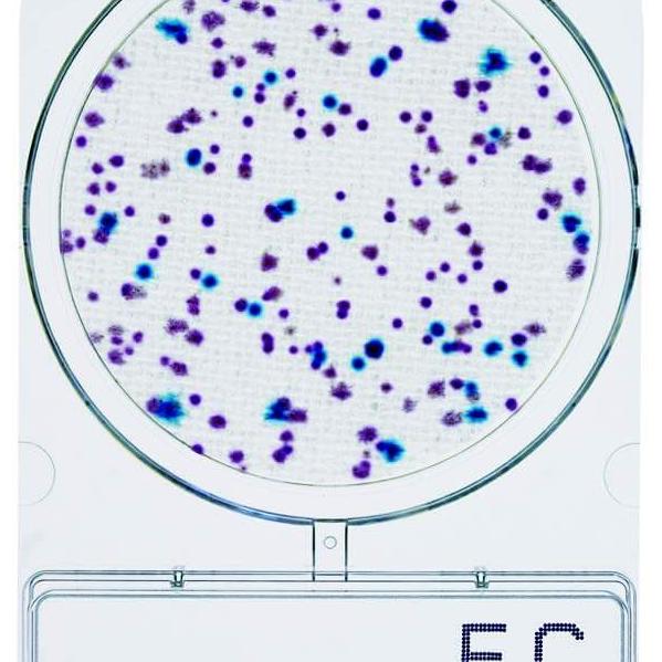 Jual Nissui Compact Dry E Coli & Coliform 240ea/karton - Kab. Bandung ...