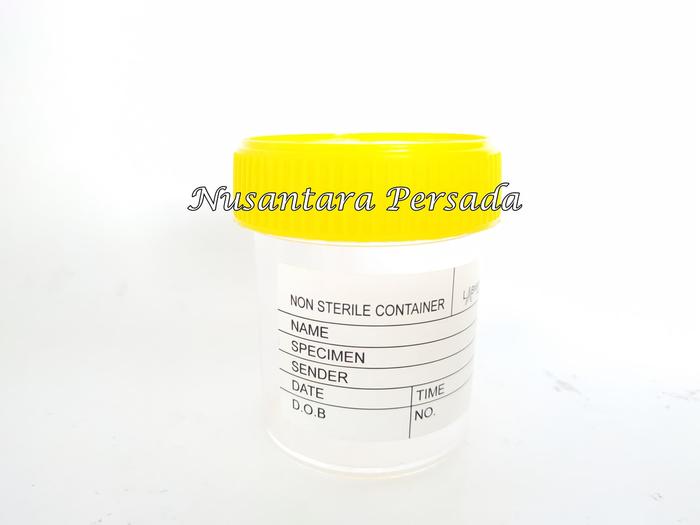 Jual Urine Container 60 ml / Tempat Sampel Urine Non Sterile - Jakarta ...
