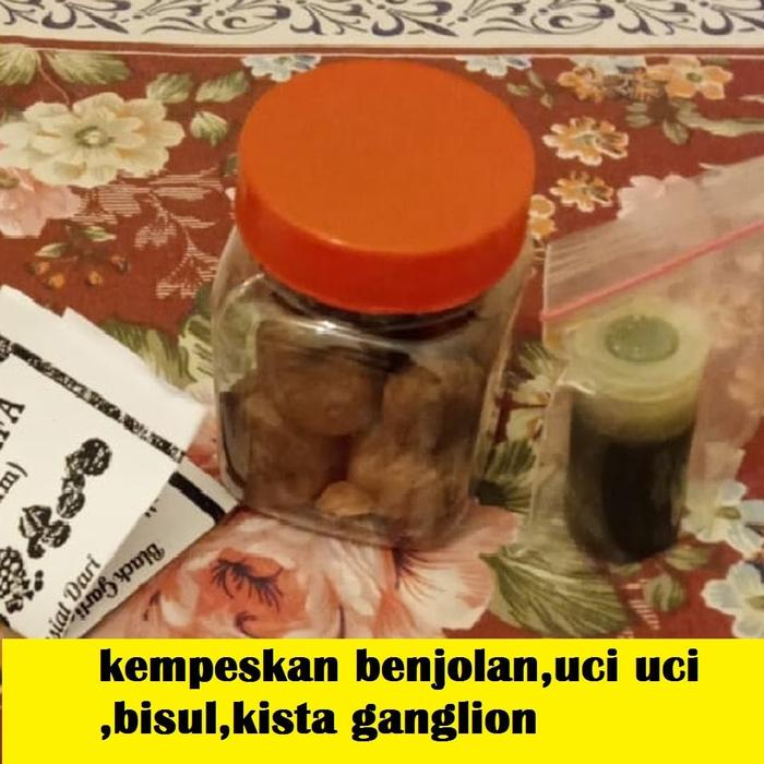 Jual obat benjolan ganglion sepaket - Kota Tangerang - tokoaisyahzen ...