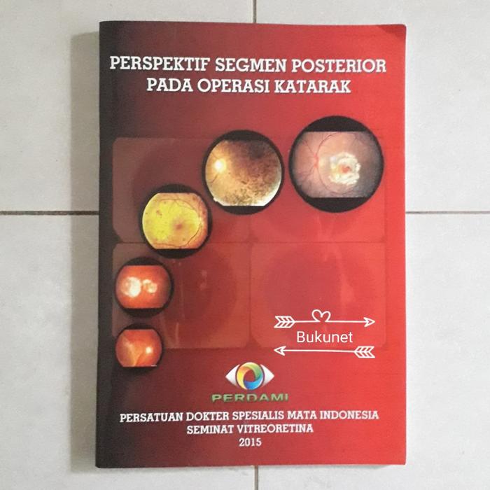 Jual Perspektif Segmen Posterior pada Operasi Katarak - Perdami - Kab ...